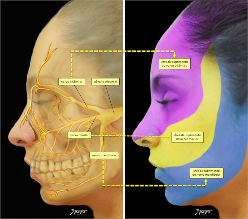 O que é Neuralgia do trigêmeo? O que causa a Neuralgia do trigêmeo ...