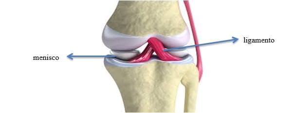 Lesão de menisco: trauma comum do joelho - Clínica Dr. Hong Jin Pai ...